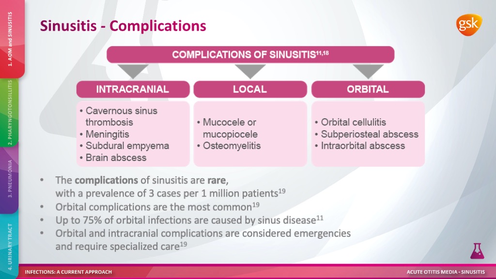 Otitis Media Aguda - Sinusitis